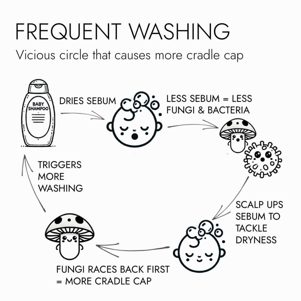 Cradle Cap Remedies