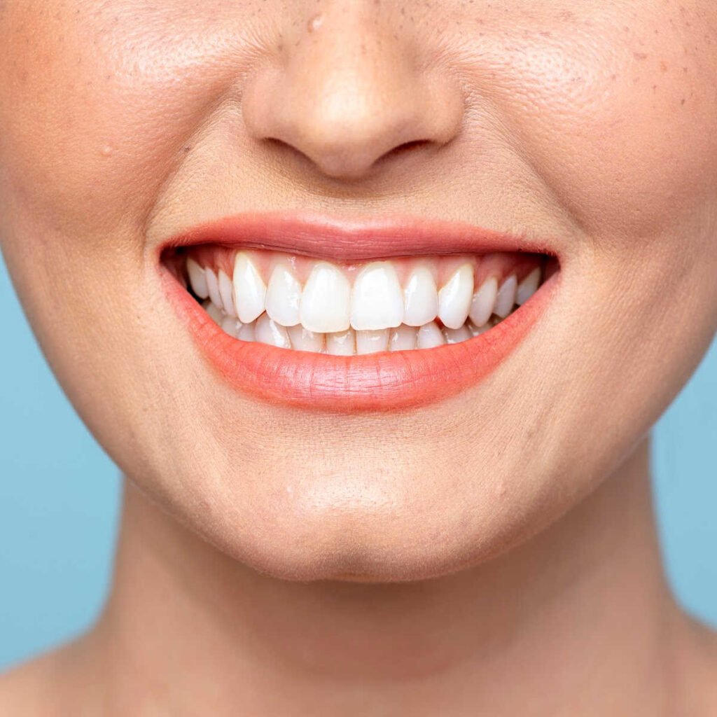 Brighten Teeth Gently